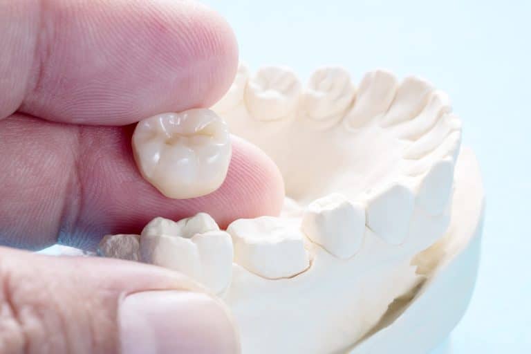 How Long Should Tooth Sensitivity Last After a Crown? - Thomas Blake, DDS