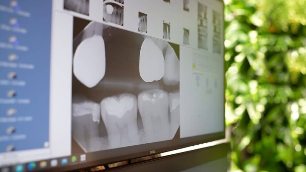 Dental Technology | Thomas Blake, DDS in Santa Barbara, CA